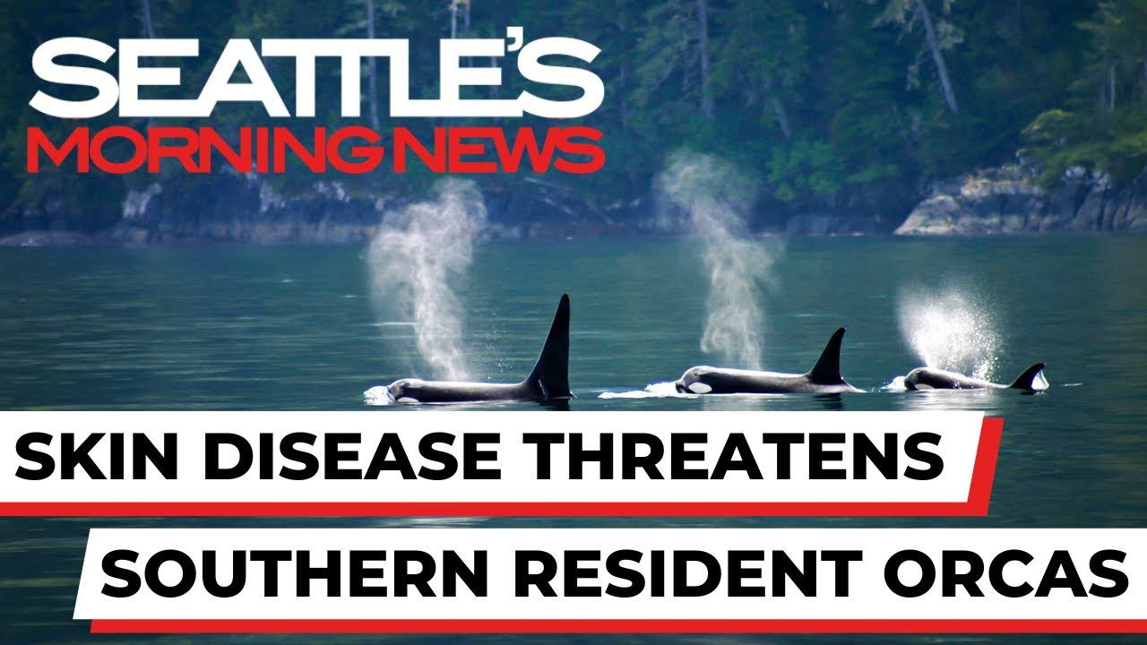Skin disease threatens Puget Sound's endangered Southern Resident orcas ...